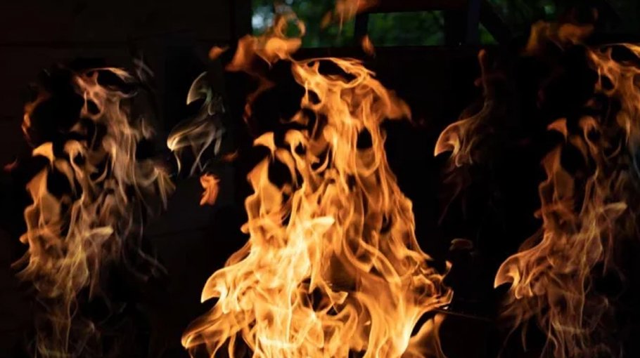 Two succumb to burn injuries - Bangladesh Post